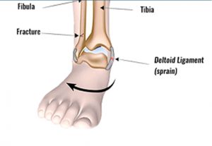 Deltoid Repair and Reconstruction - Dr Warren